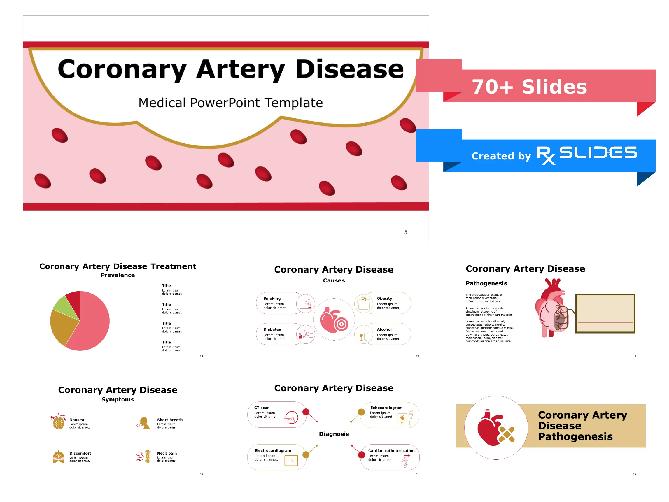Download Coronary Artery Disease PowerPoint Template|RxSlides